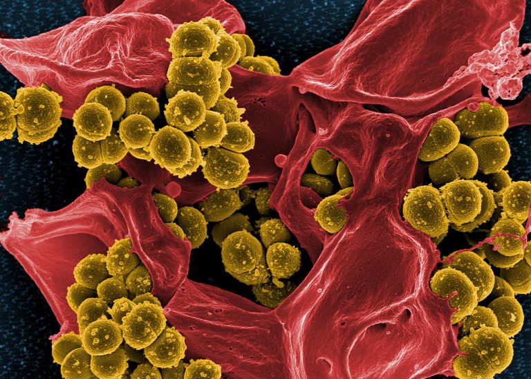 How Do You Test Staphylococcus aureus? – CD Bioparticles Blog