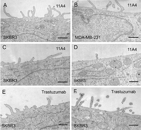 Application of Colloidal Gold on Electron Microscopy - CD Bioparticles