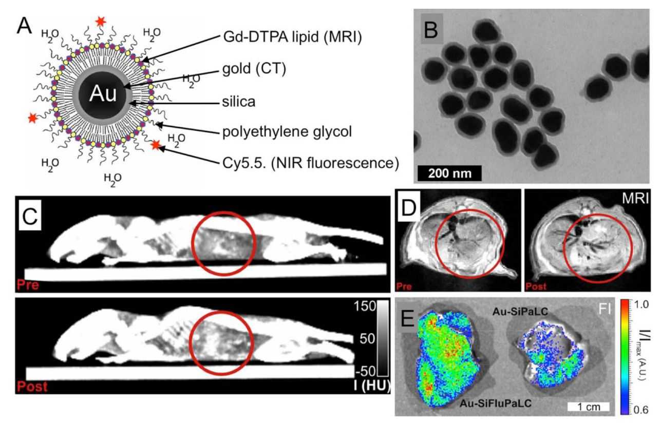 Gold Nanoparticles as CT Contrast Agents - CD Bioparticles